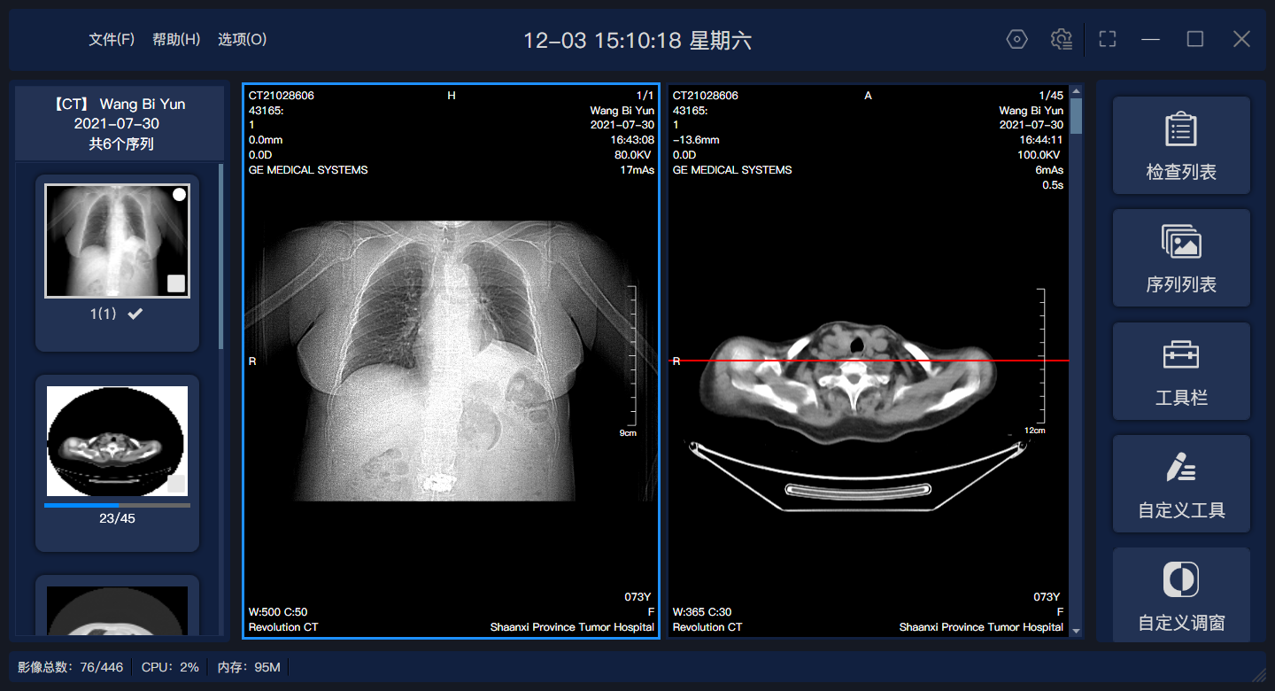罗万PACS影像系统-非接触式(体感)PACS